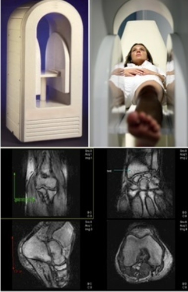 Using low field MRI for quick, effective and accessible diagnoses of ...