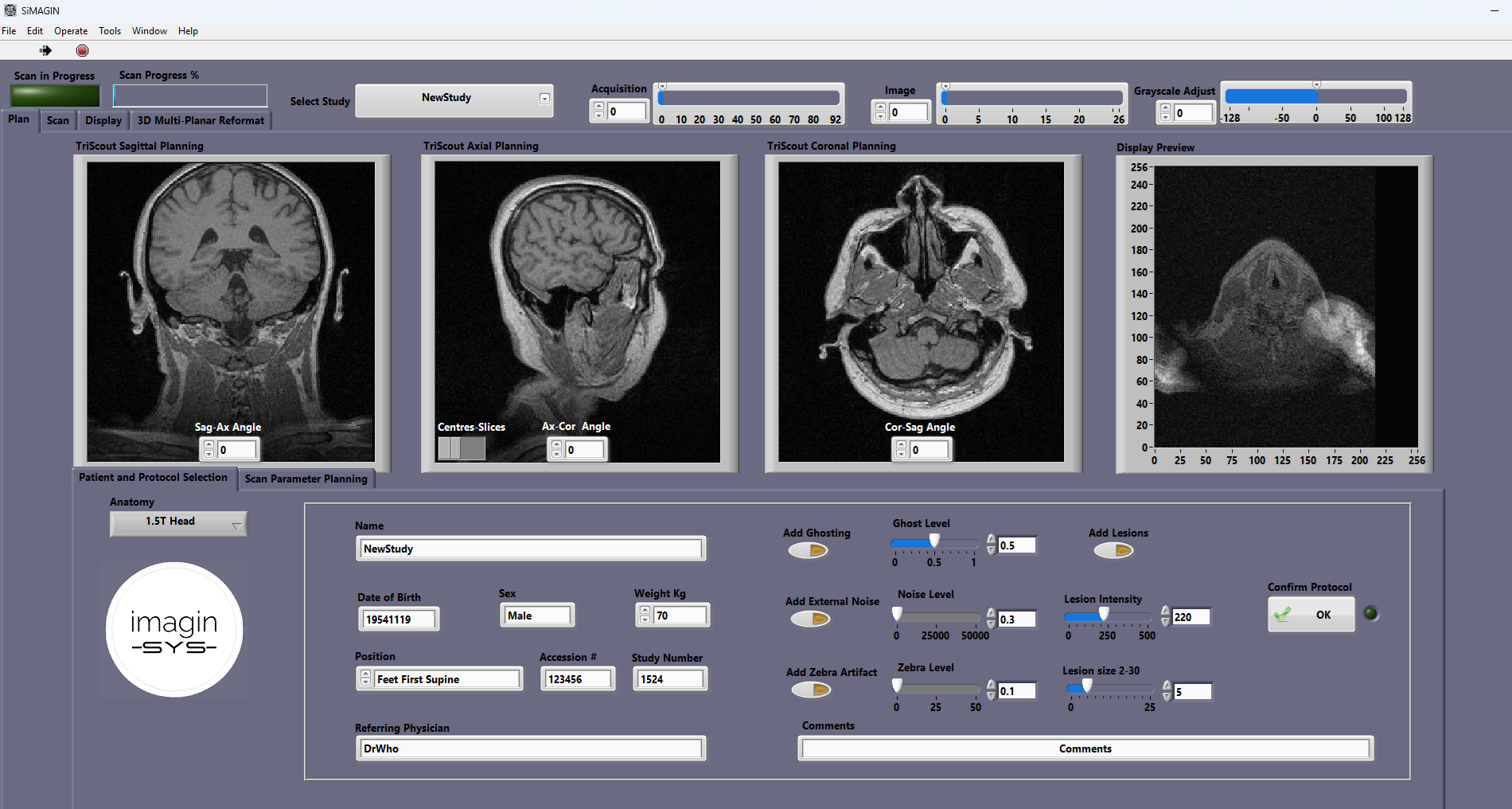SiMAGIN MRI Simulator(v24 Trial) - imaginSYS